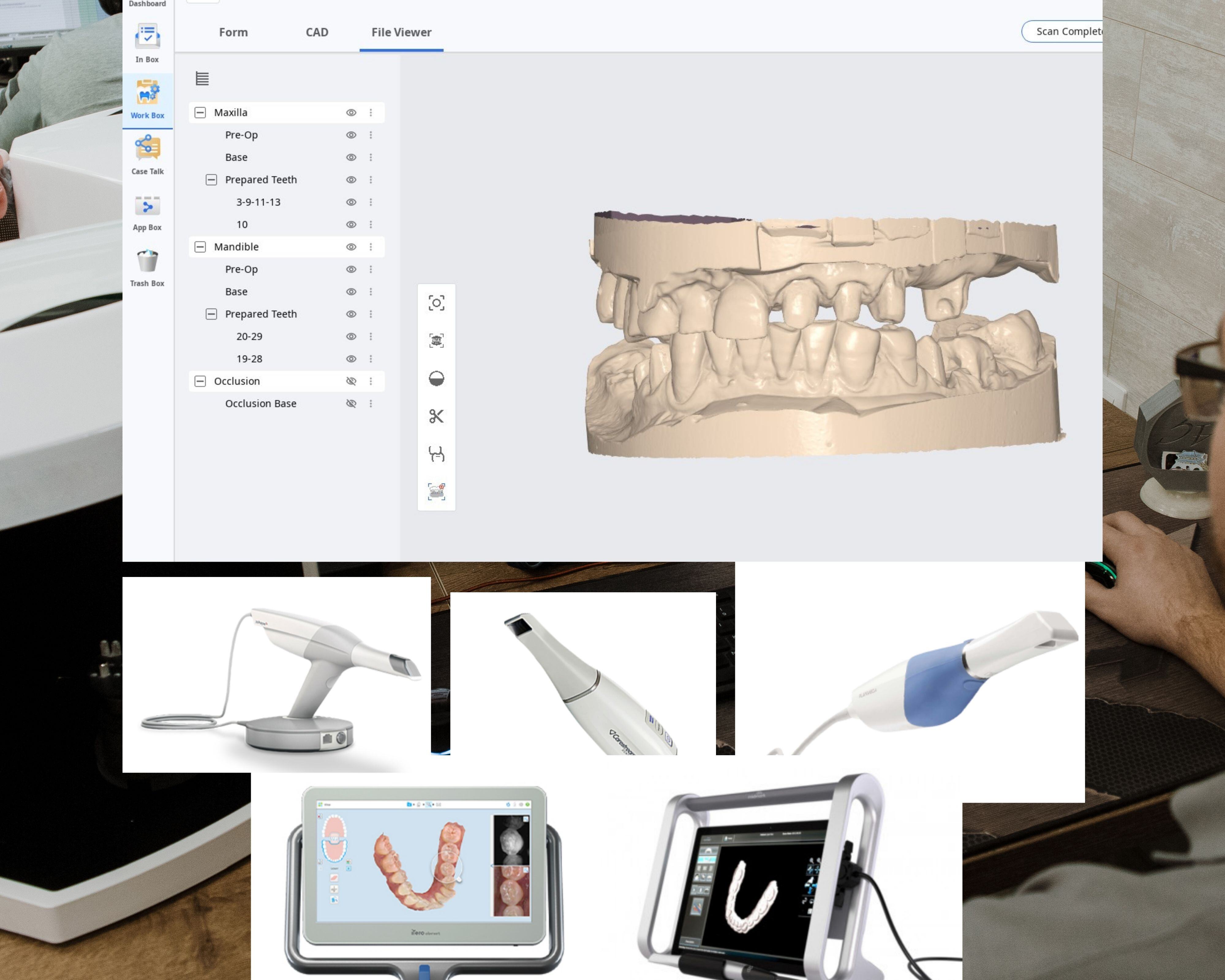 🔍 Digital Intraoral Scanning: Essential Precautions for Perfect Accuracy!
