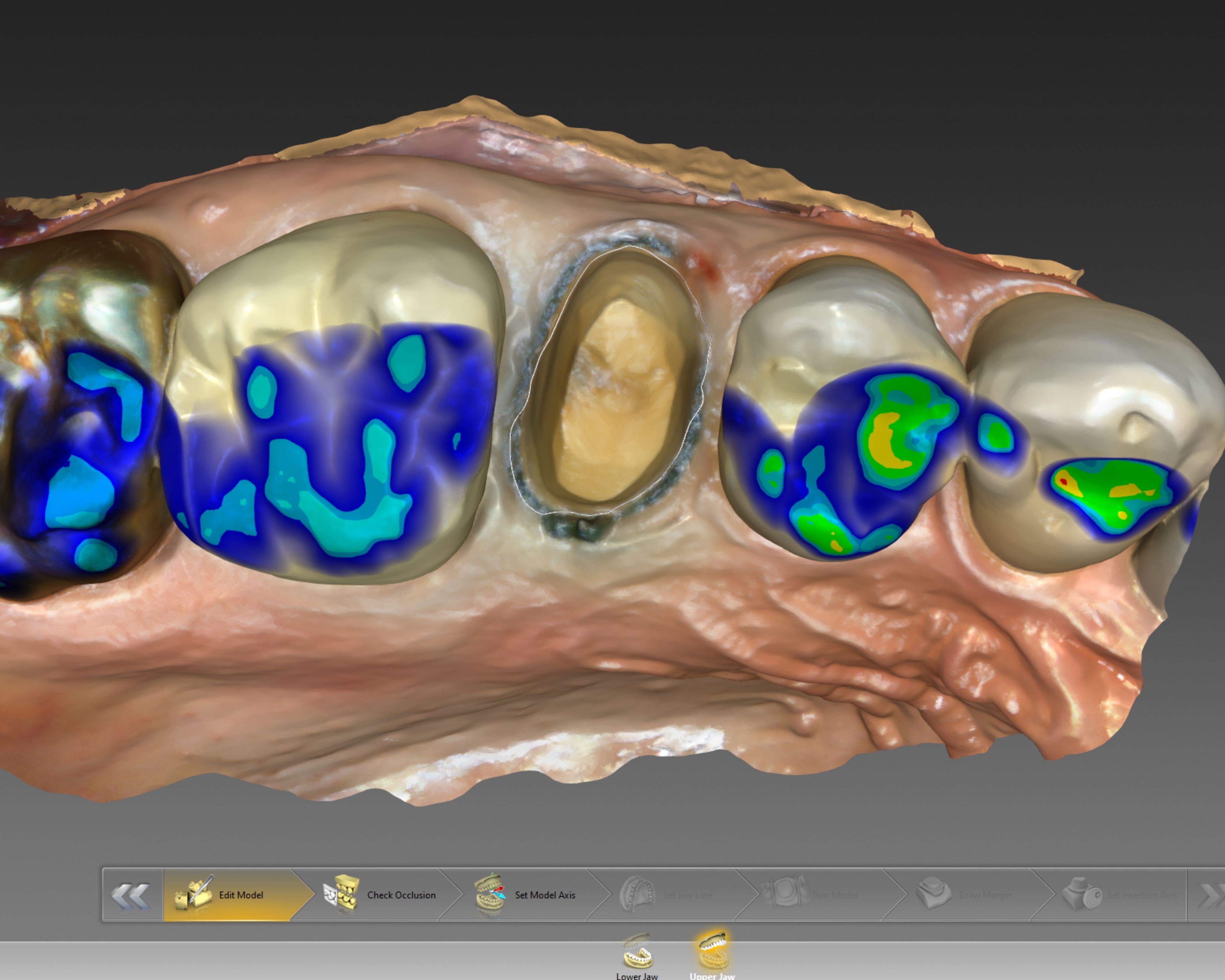 Master Digital Intraoral Scanning: The Ultimate Guide
