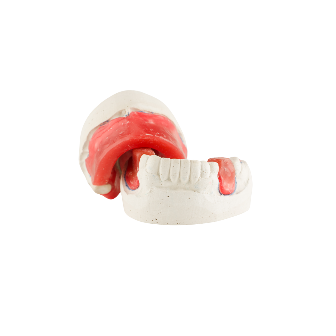 Essential Checkpoints for Denture Wax Bite Try-In