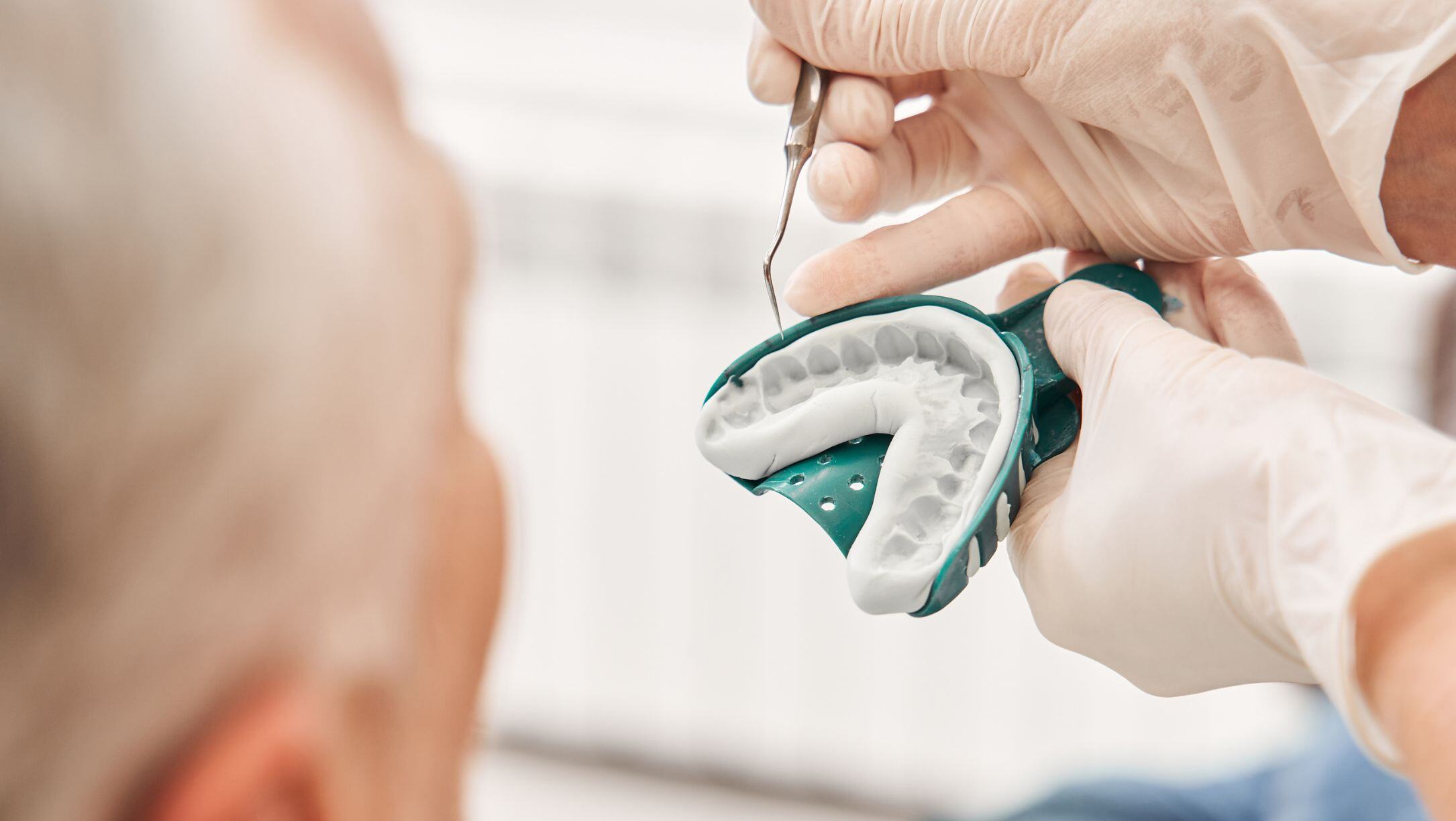 How To Take The Perfect Dental Impression